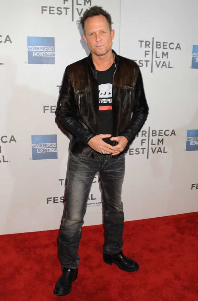 Saviez-vous que ces stars avaient été amputées