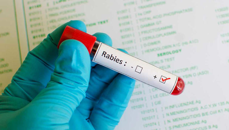 Cat tests positive for rabies in Jamestown, health officials say