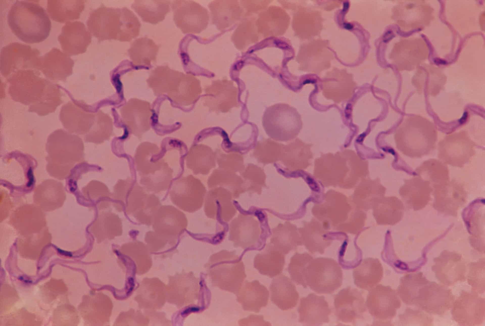 Chagas disease: The parasite that lurks for decades
