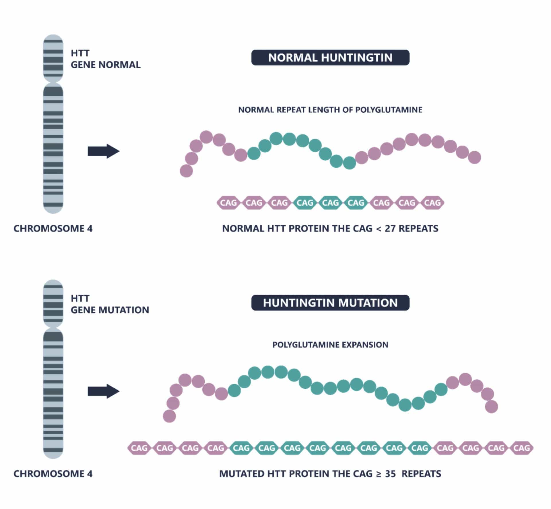 Huntington's disease: what is this rare neurodegenerative disorder?