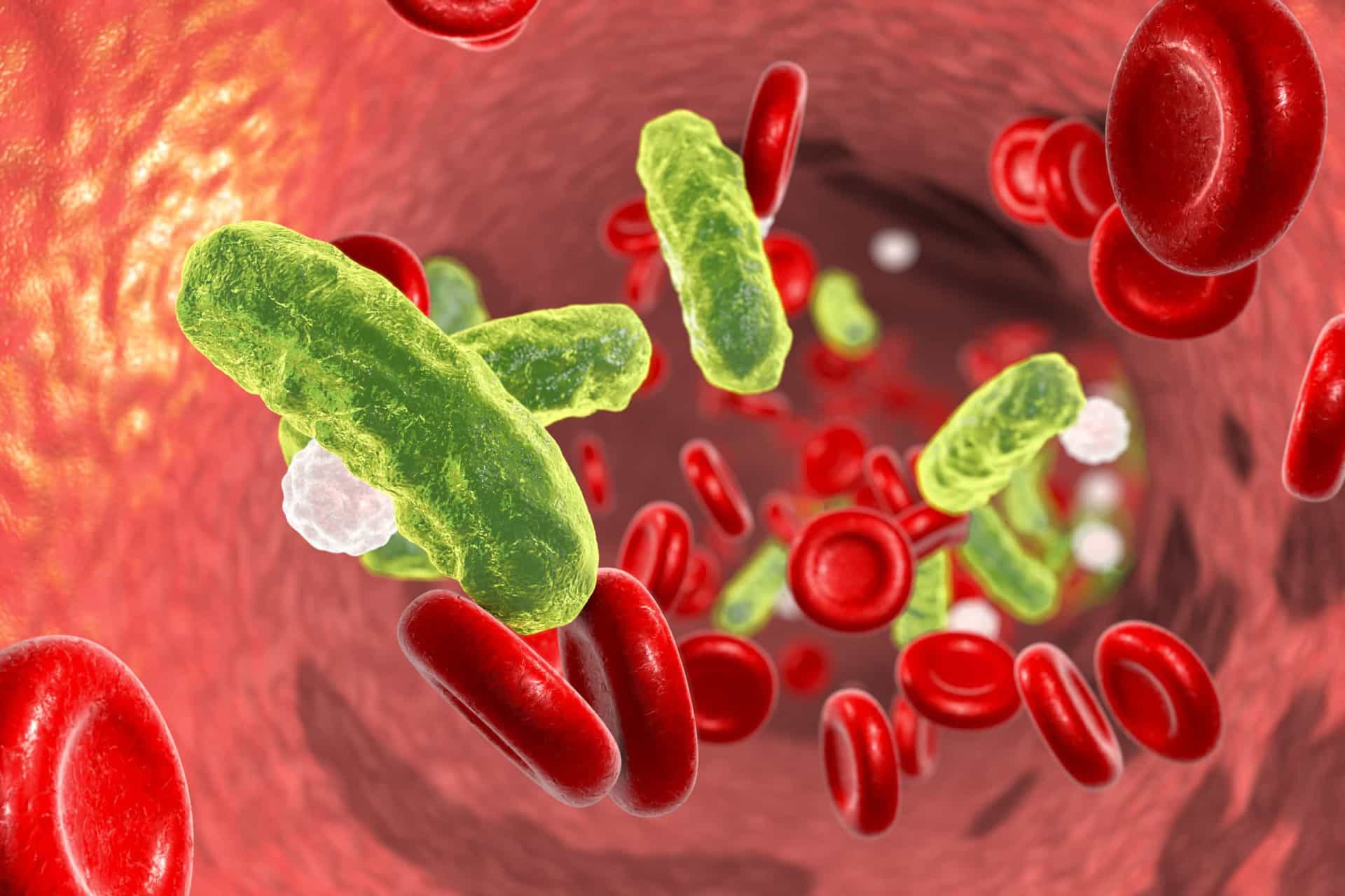 The devastating condition known as sepsis