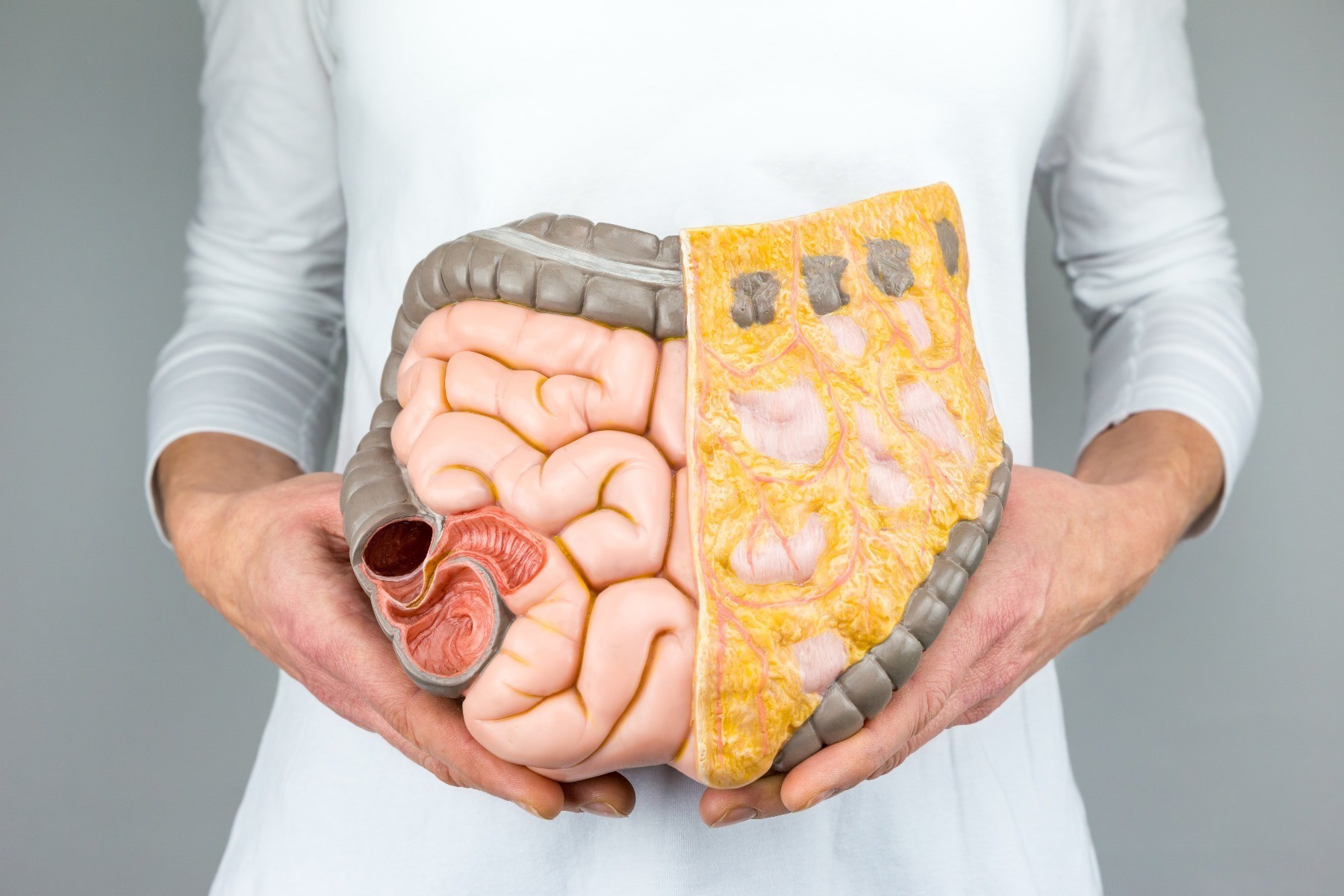 Could you be at risk of developing colon cancer?