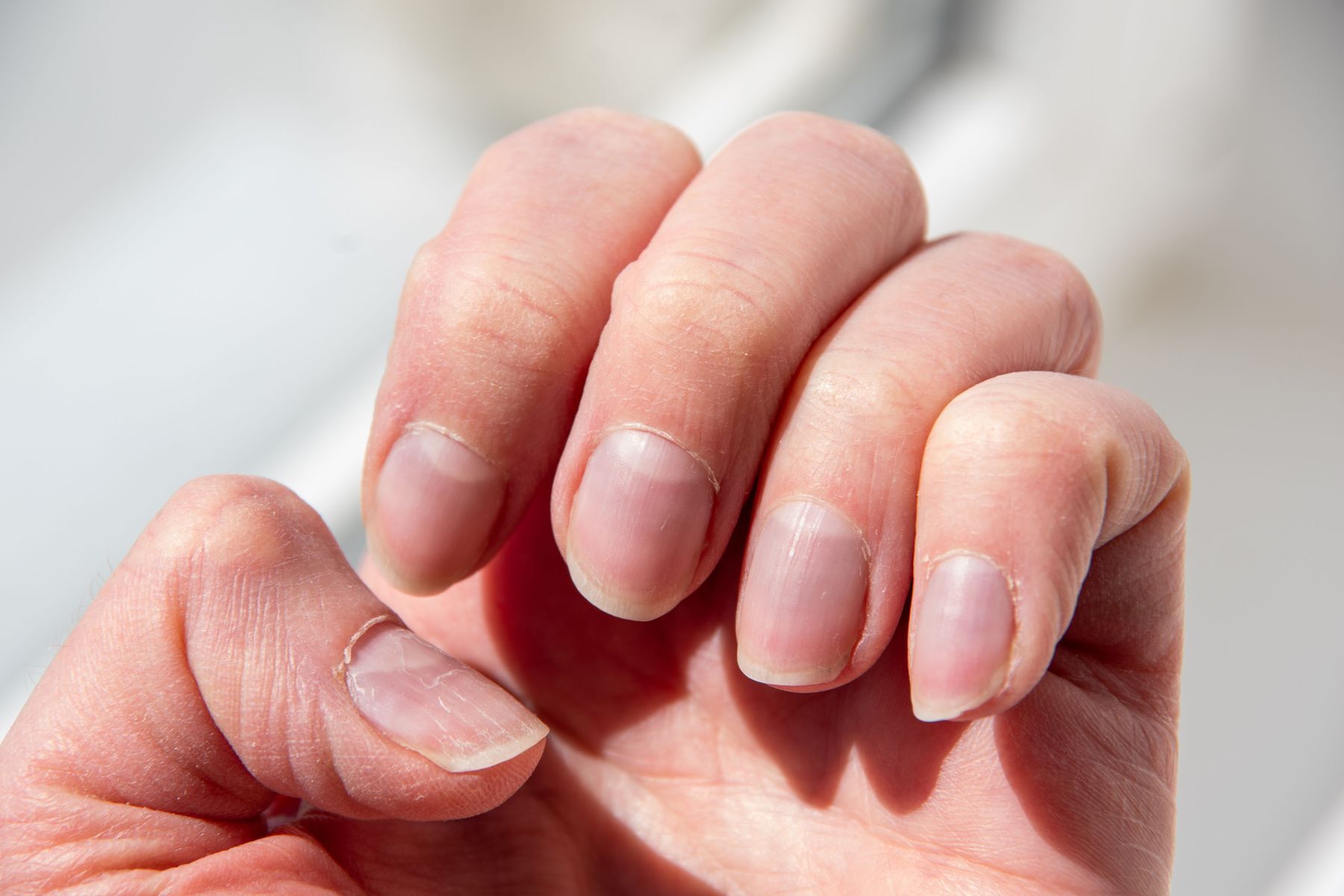 13 signs of anemia you shouldn’t ignore