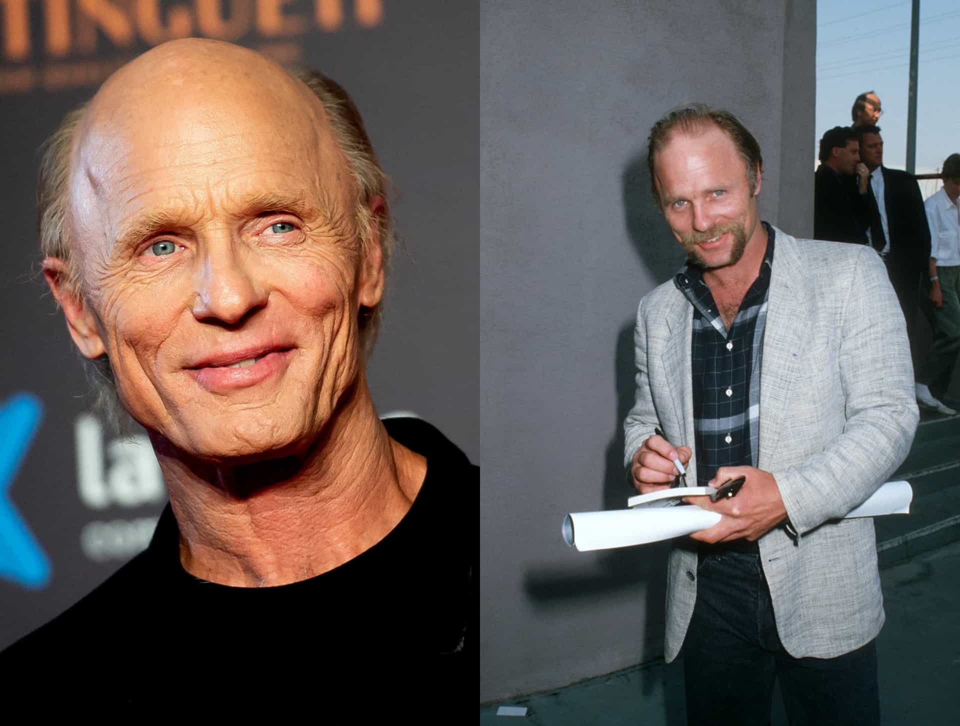 Bald celebrities when they had hair