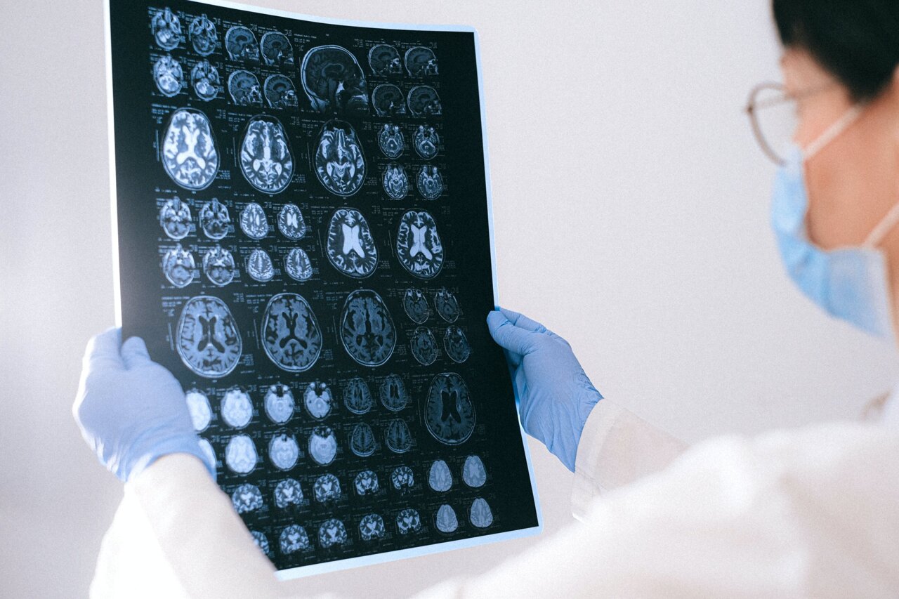 New immunotherapy strategy targets aggressive brain tumors and their ...
