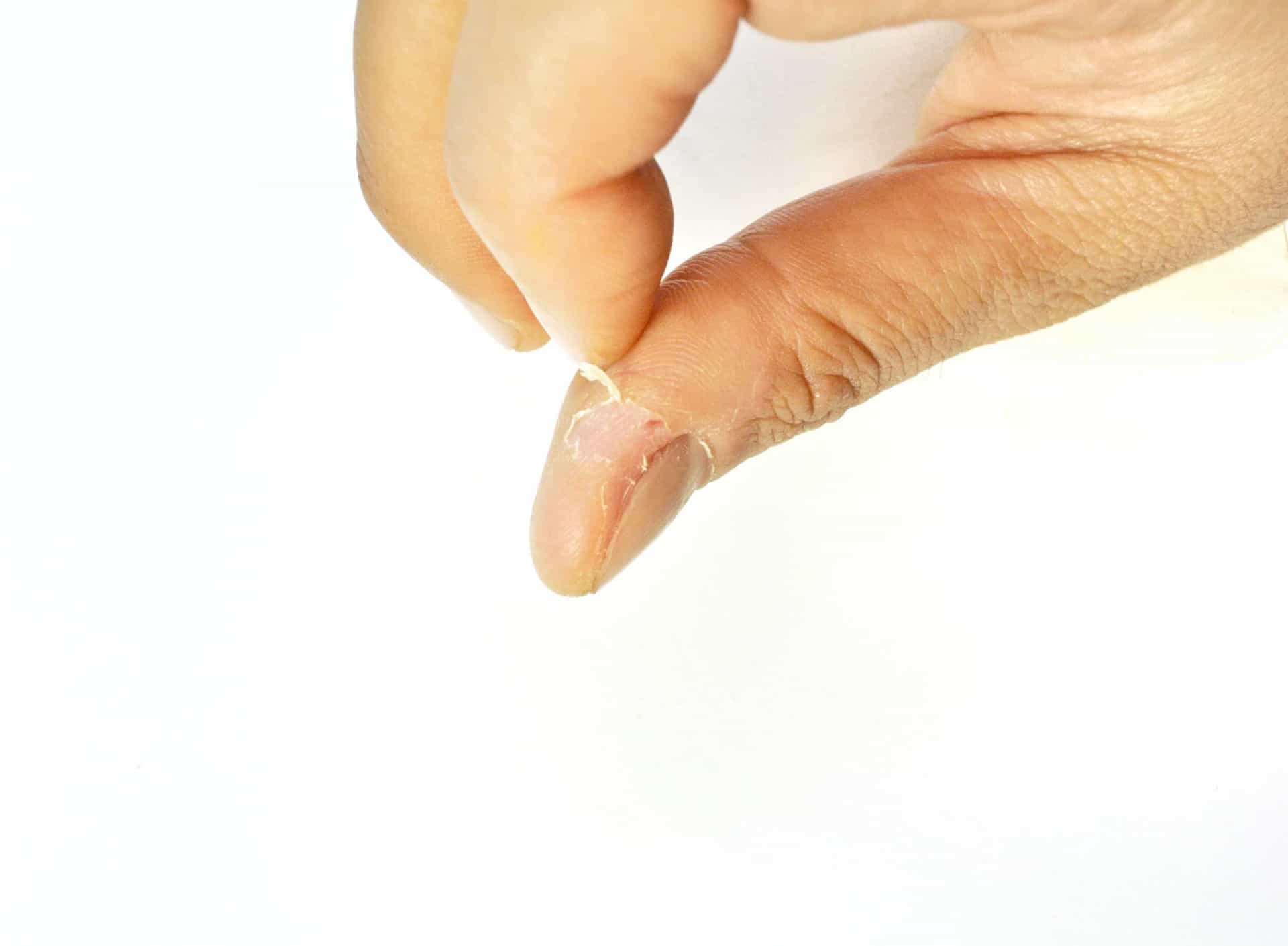 Prader-Willi syndrome: the rare condition affecting infants and children