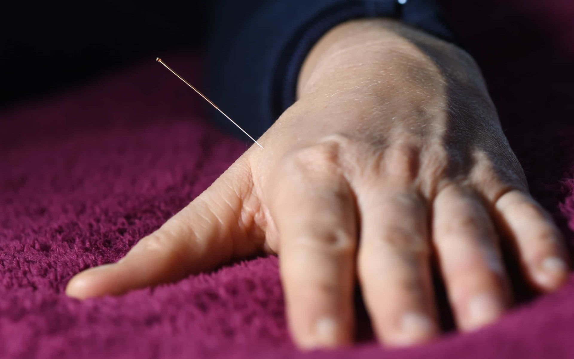 Natural remedies to combat rheumatoid arthritis