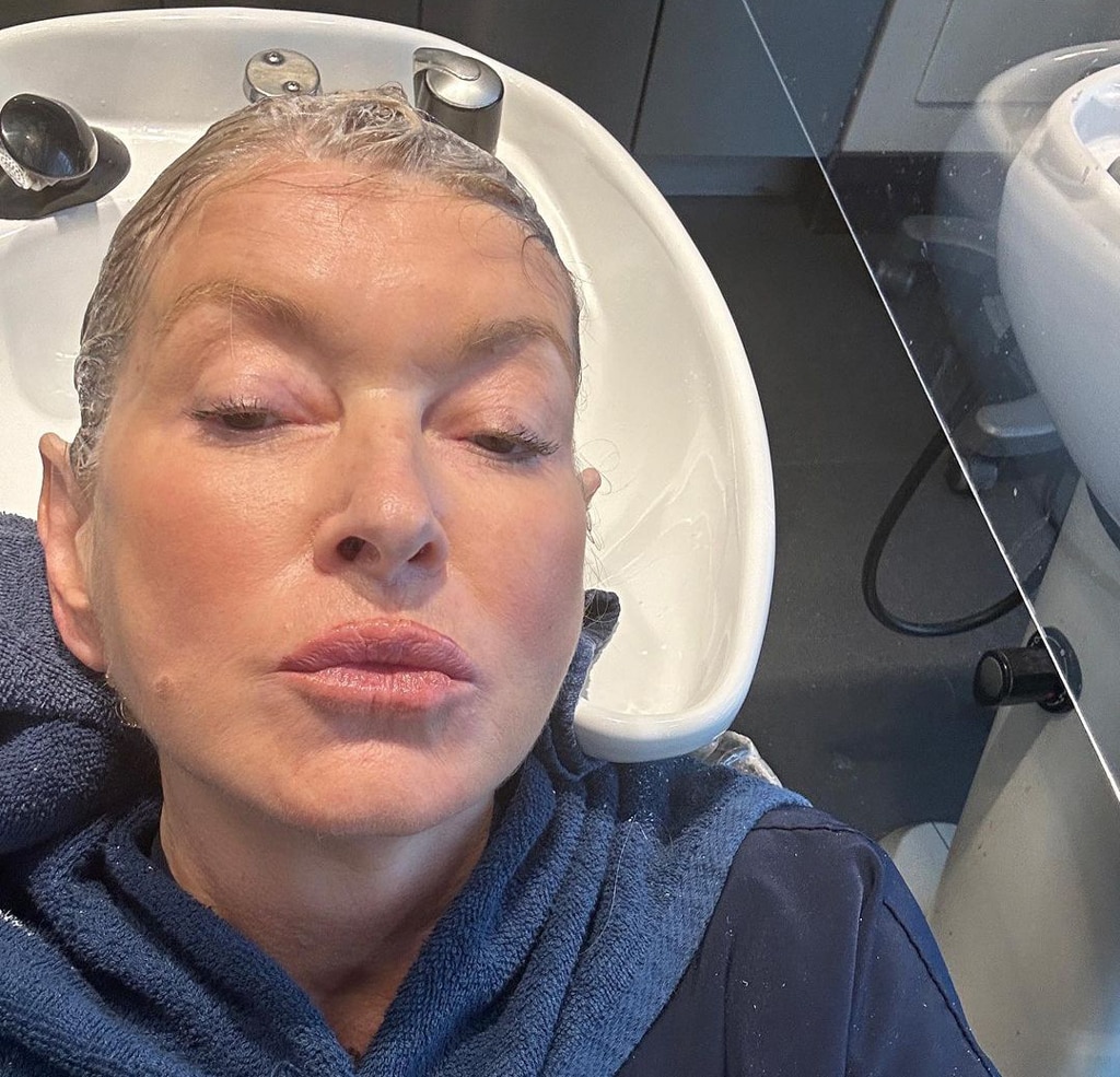 Celebs Who've Admitted to Getting Plastic Surgery or Cosmetic Procedures