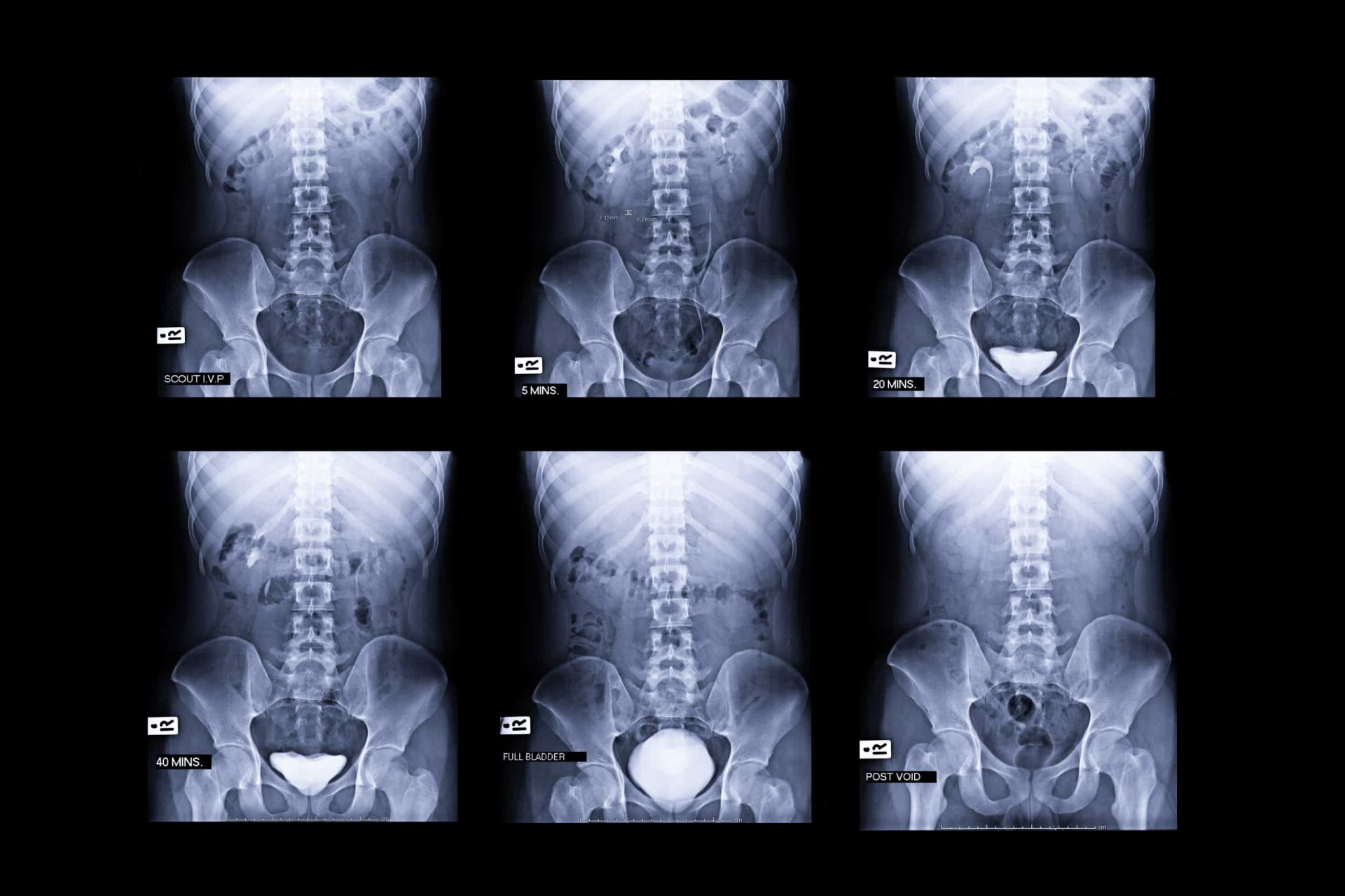Things you think cause cancer (but actually don't)
