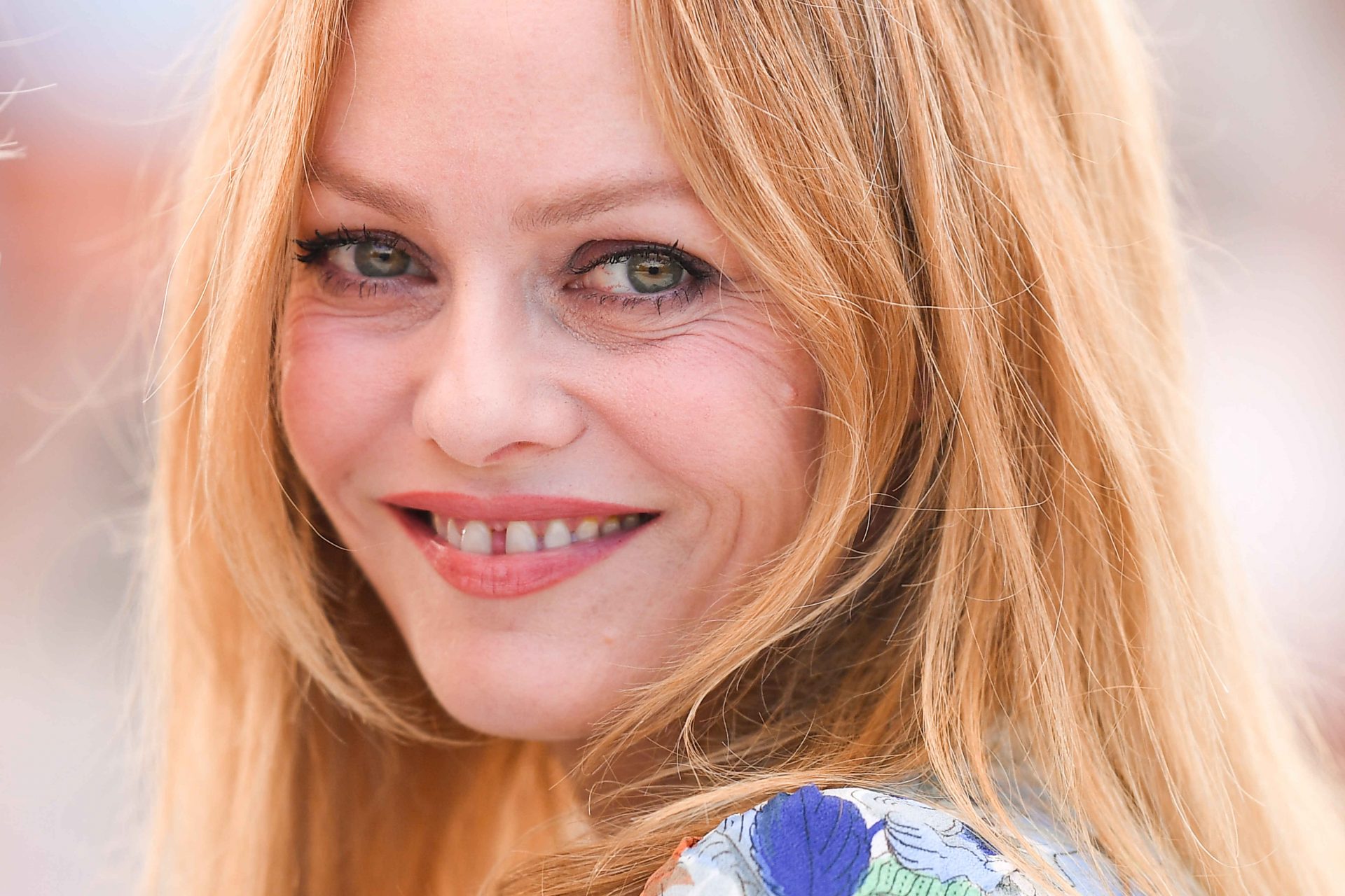 Celebrities with unusual physical features