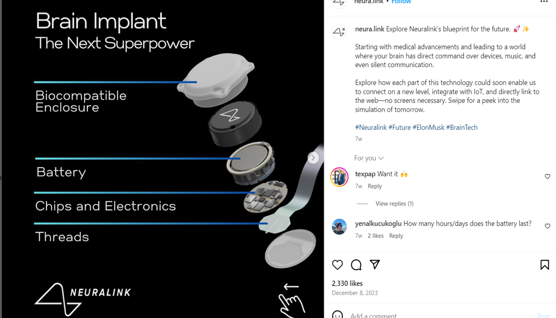 Telepathy: The chip Elon Musk's company just implanted in someone’s brain
