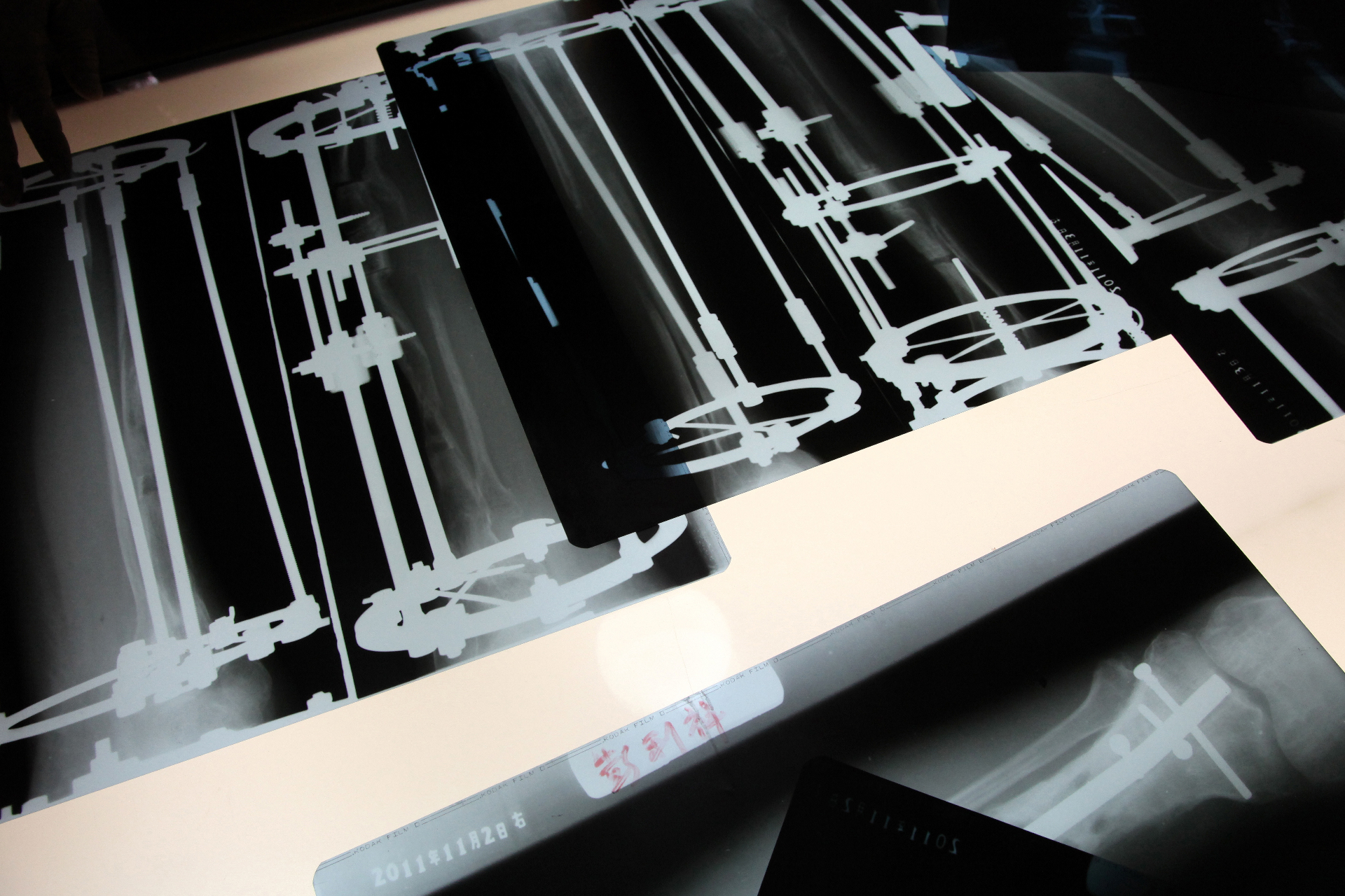 The surprising benefits of being short