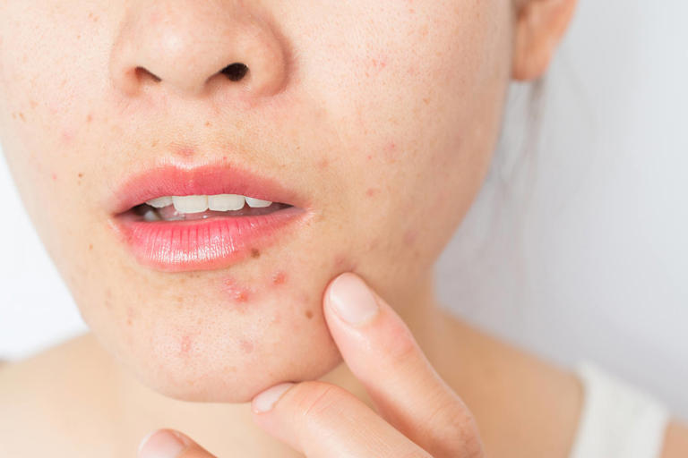 Pictures and expert advice to help you identify 23 common skin rashes