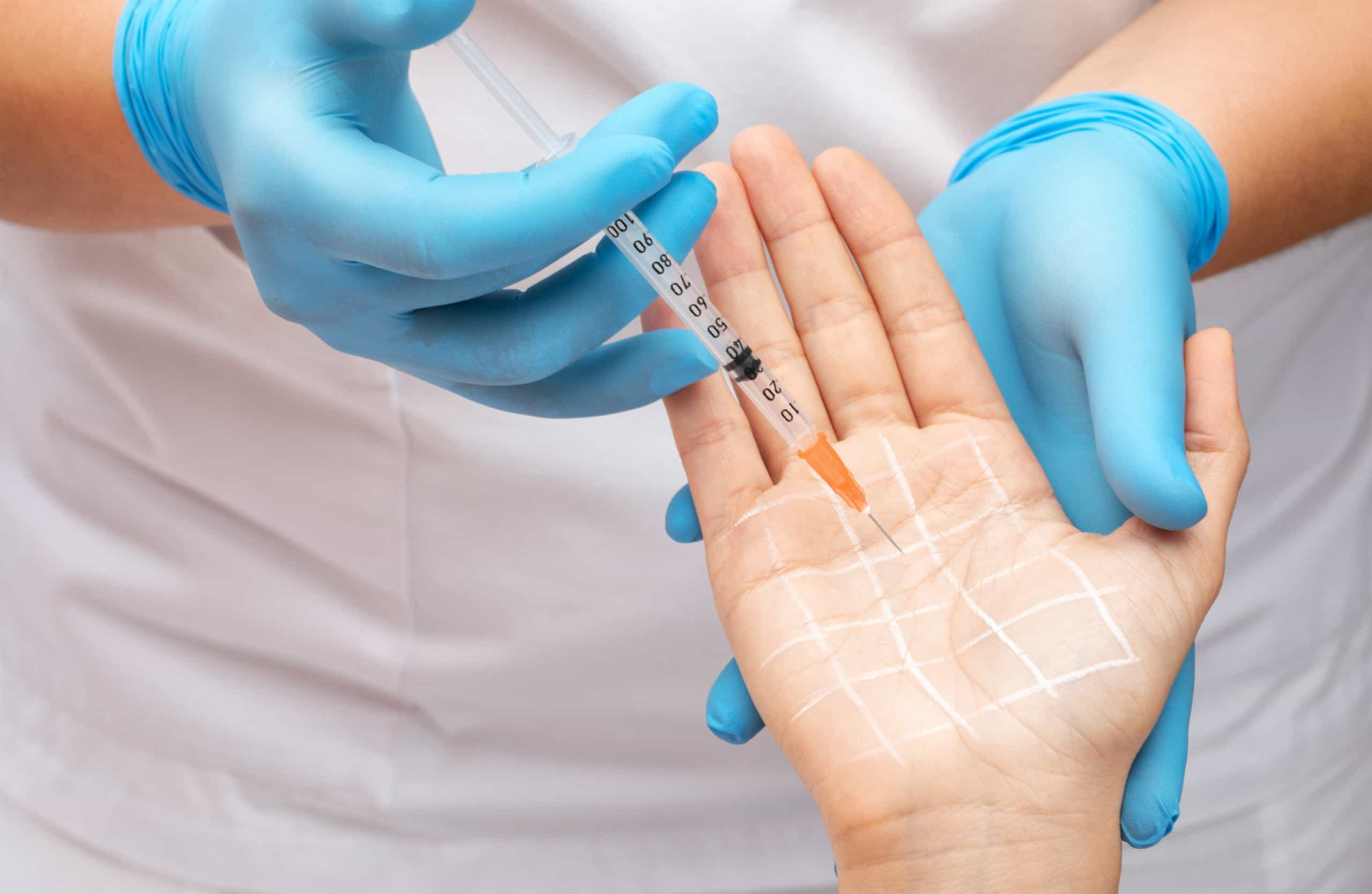 What you should know before getting Botox