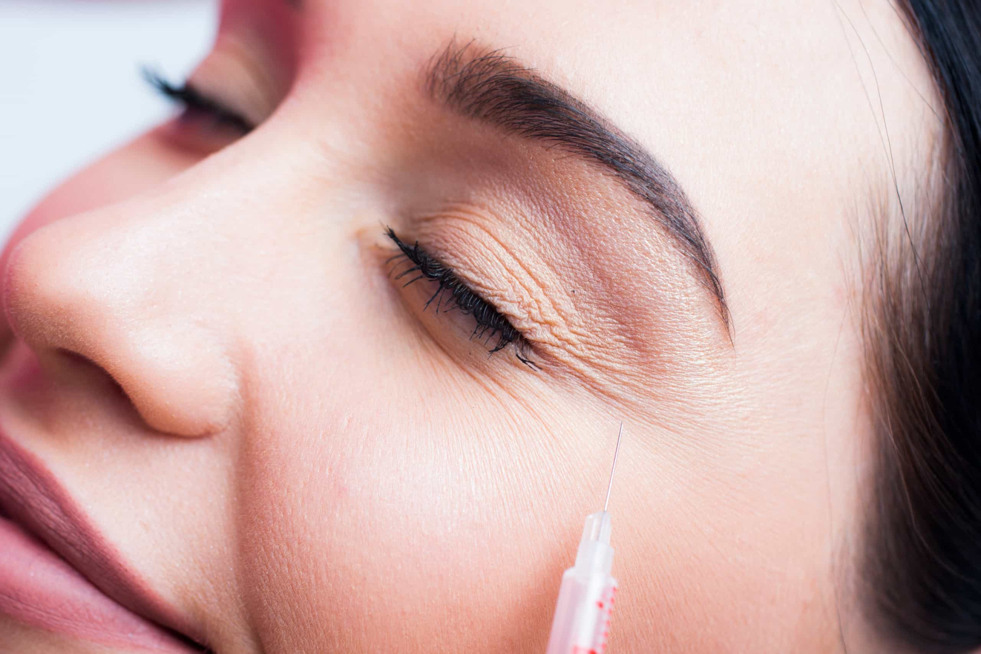 What you should know before getting Botox