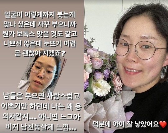 둘째 출산 박슬기 86년 “얼굴이 이렇게까지 붓는 게 맞나 싶다”