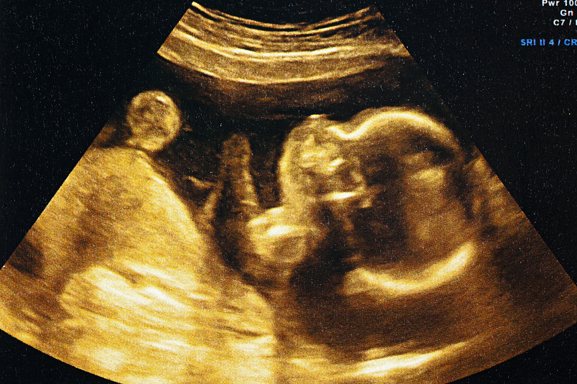Mind-blowing things you had no idea happen in the womb