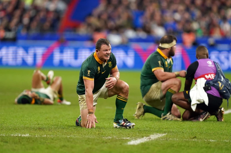 CONFIRMED: Springbok out for months with broken tibia – Is his Test ...