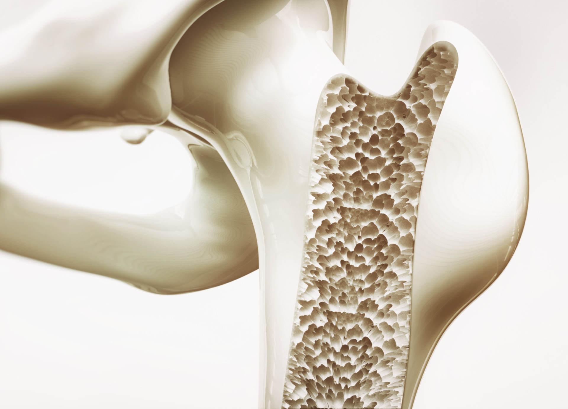 Quelles sont les maladies qui attaquent les os du corps humain