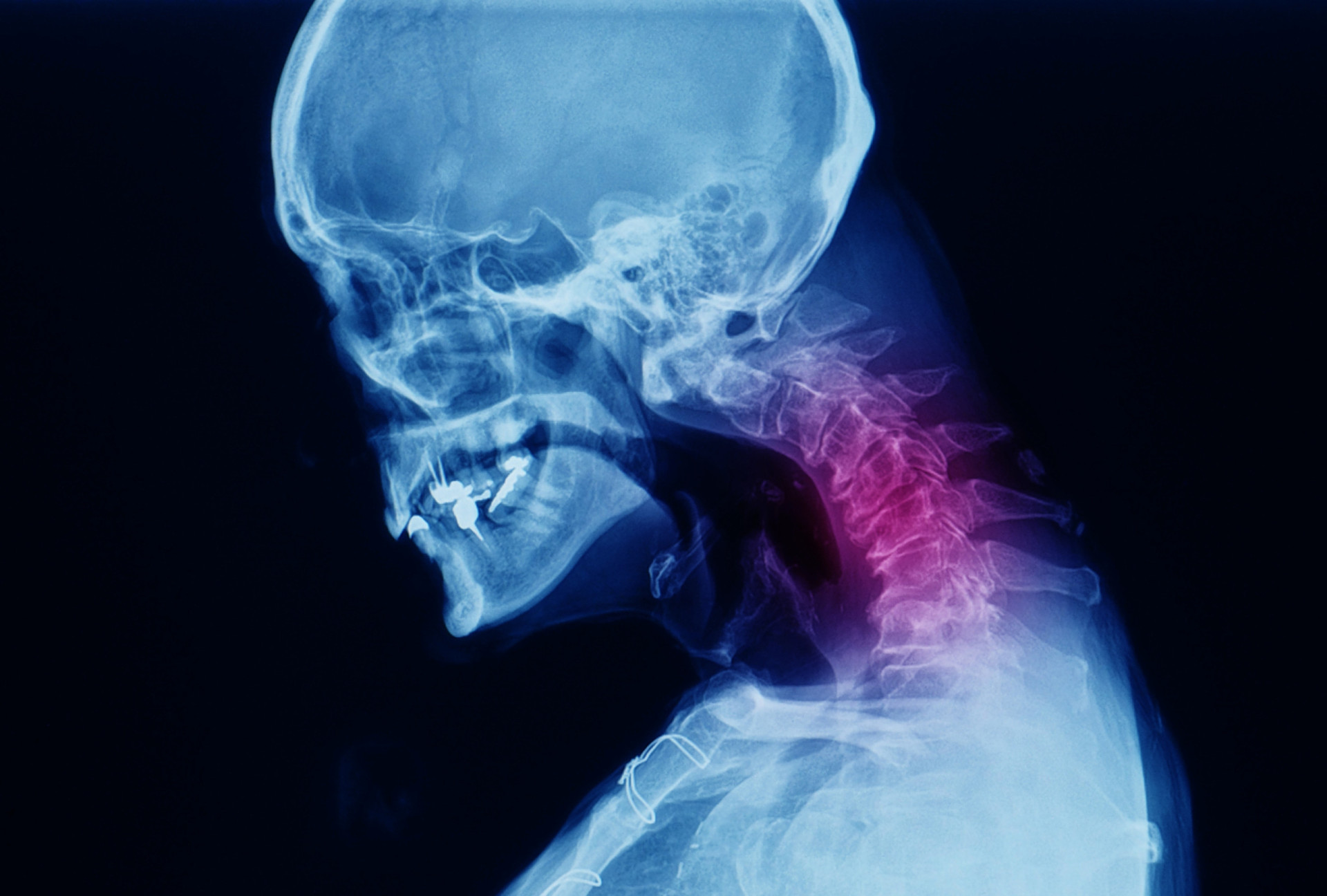 R$ 81 milhões: Goleiro da Seleção Brasileira, Bento se aproxima de ...