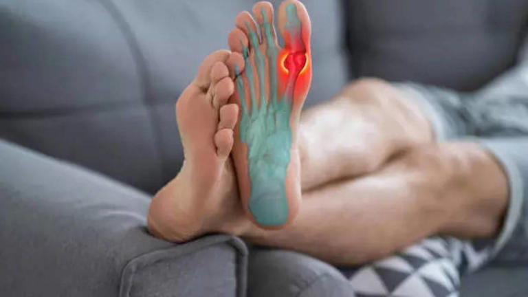5 Red Flag Symptoms Of High Uric Acid That Appear In Your Hands And Legs