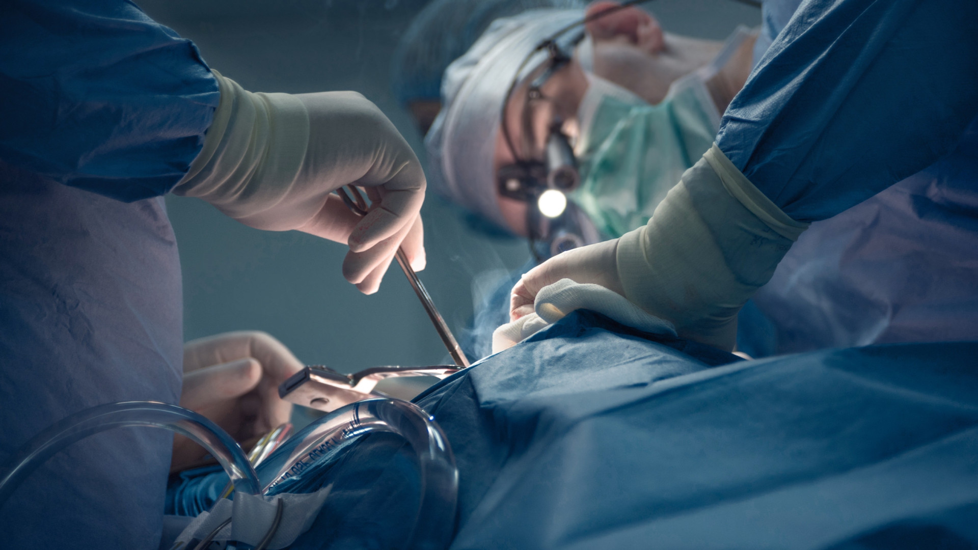 Major types of abdominal surgeries, and their recovery time