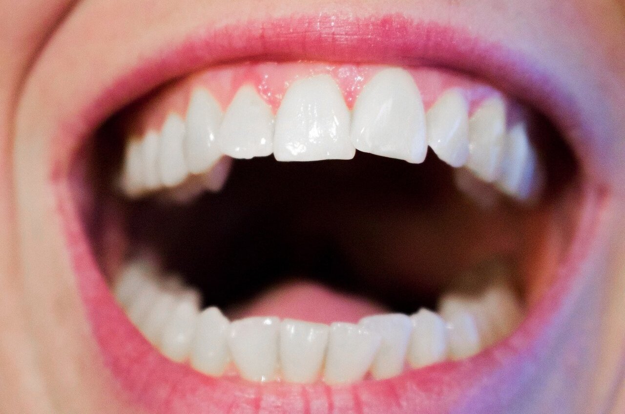 From vigorous brushing to clear aligners, here's what might be causing ...