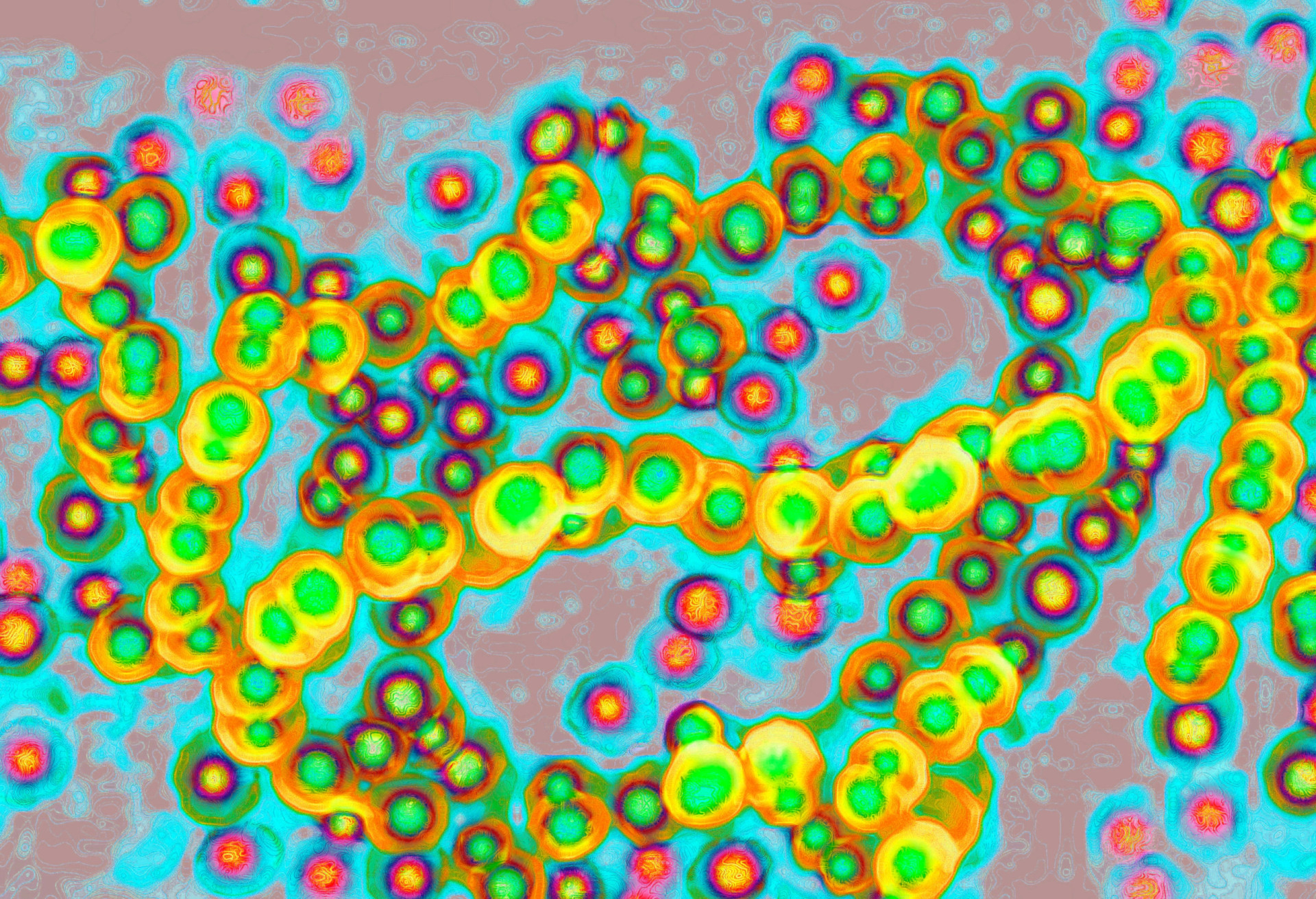 What is streptococcal toxic shock syndrome, and why is Japan worried?