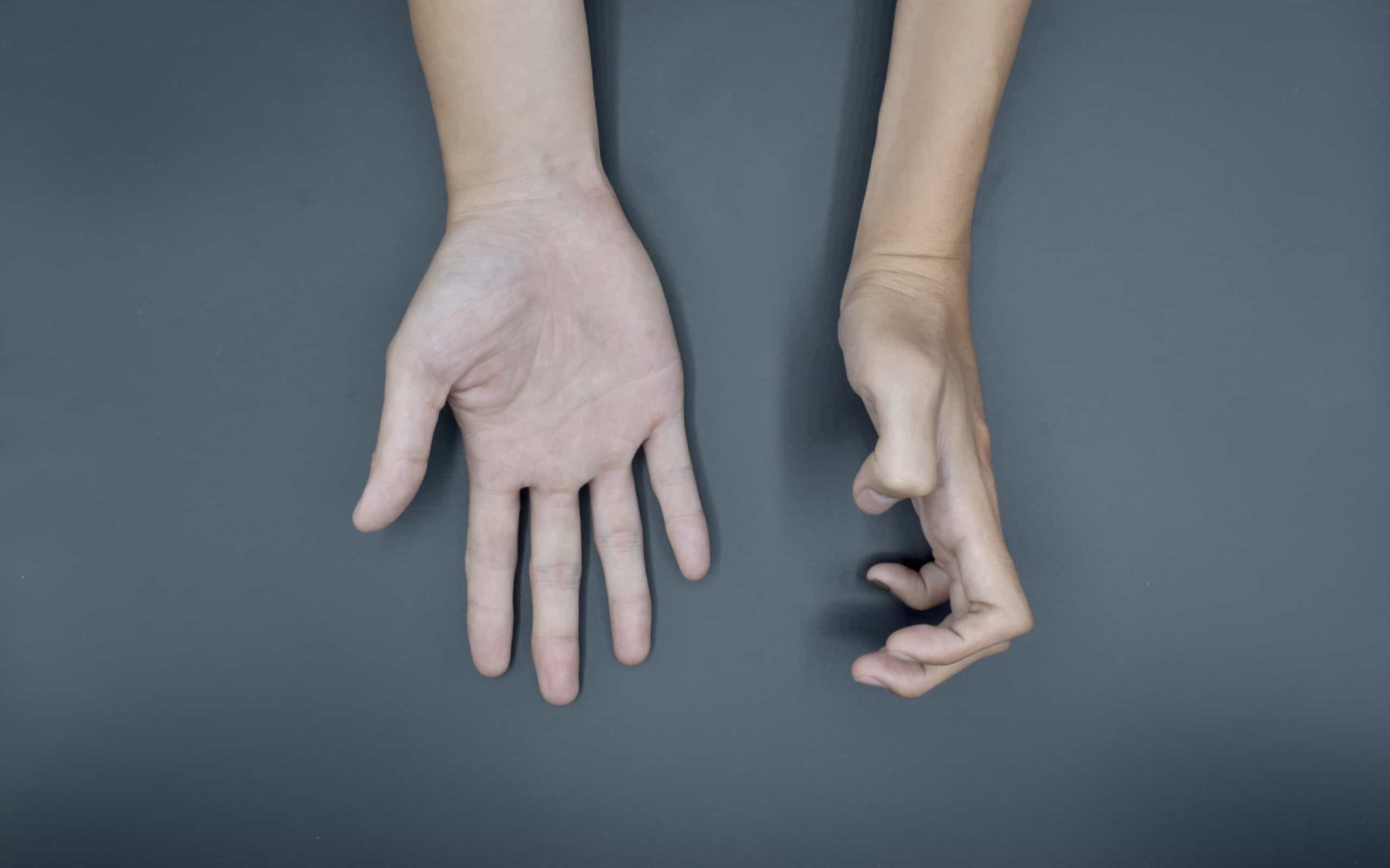 The Mézières method: how and why it works