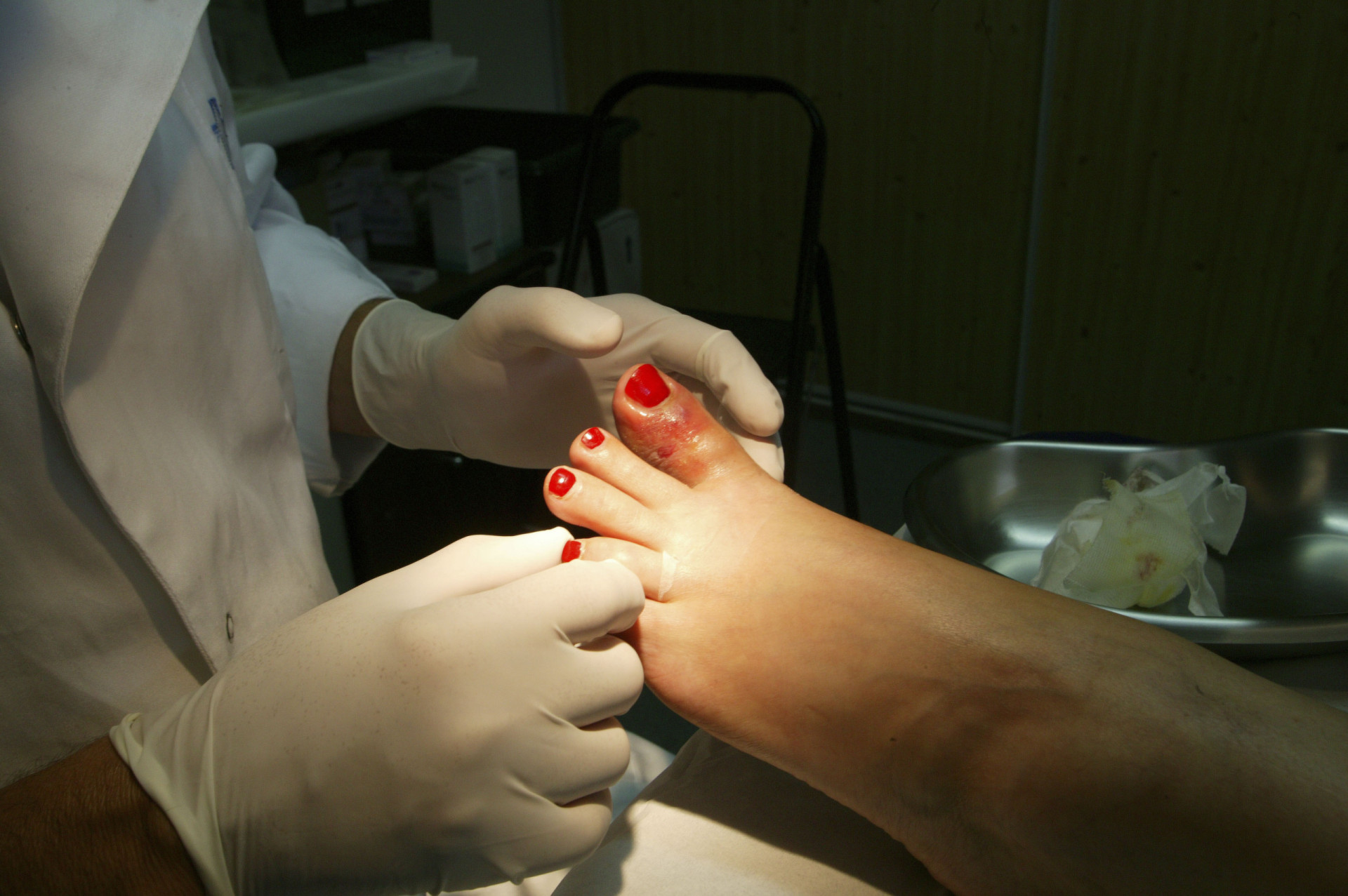 O que suas unhas revelam sobre sua saúde!