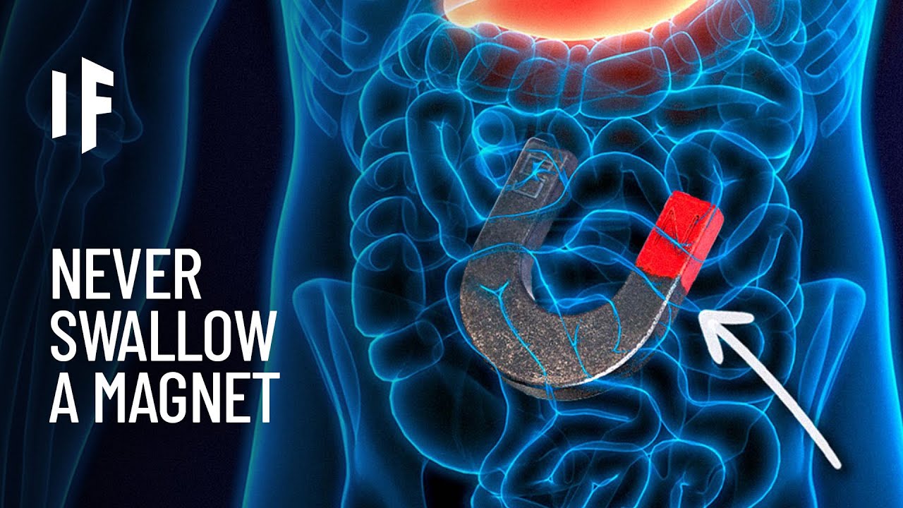 What happens if you swallow the world’s strongest magnet?
