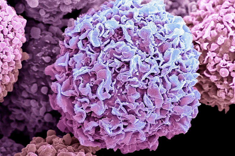 Eating preservatives seemed to raise this cancer risk in a new French study