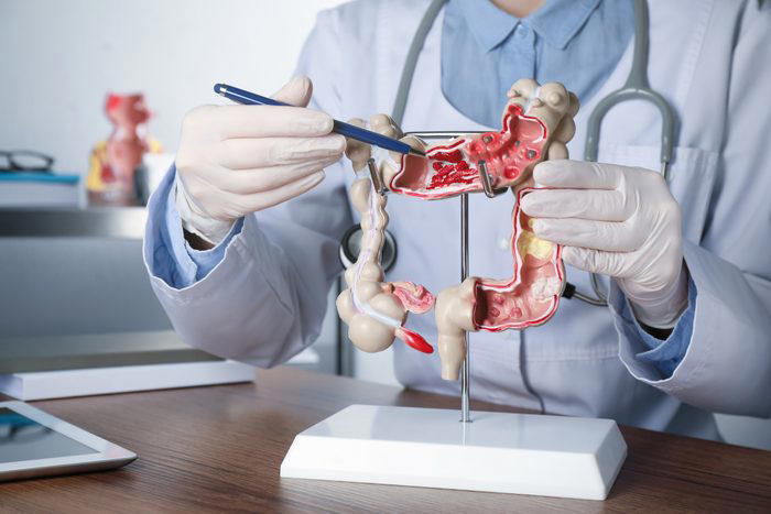 8 symptoms of colon polyps