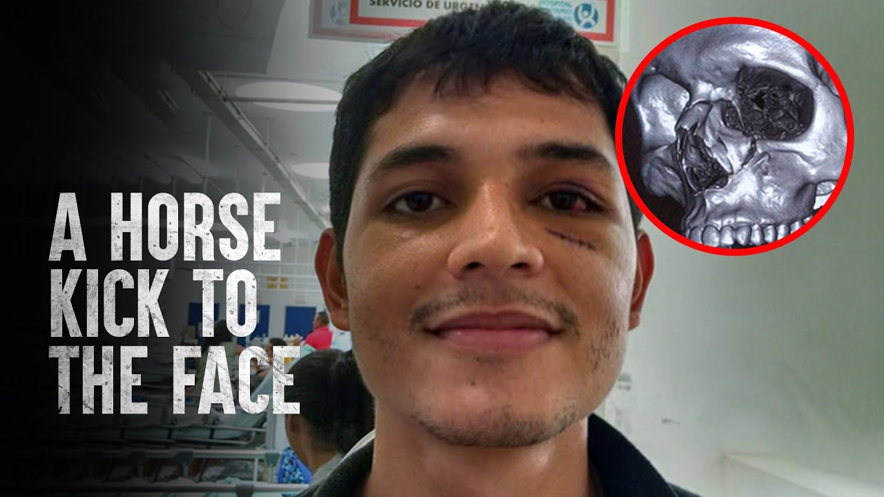 Escaping a Horse Attack