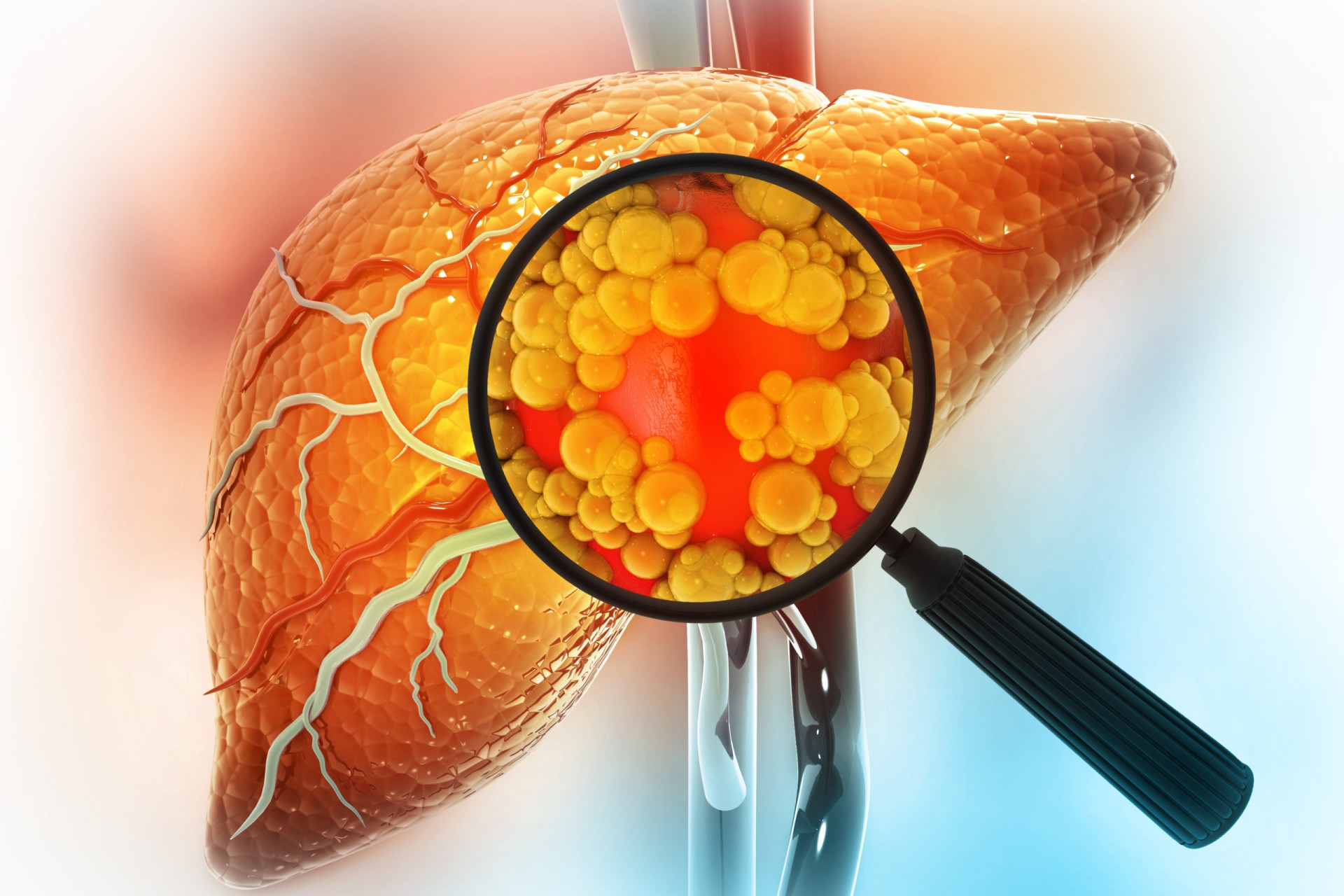How Long Can You Live With Untreated Hepatitis C 1128