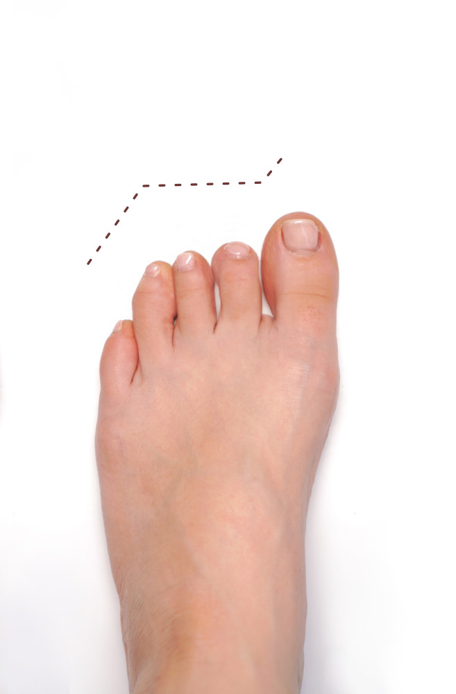 What does the shape of your toes reveal about you?