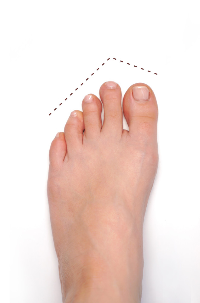 What does the shape of your toes reveal about you?