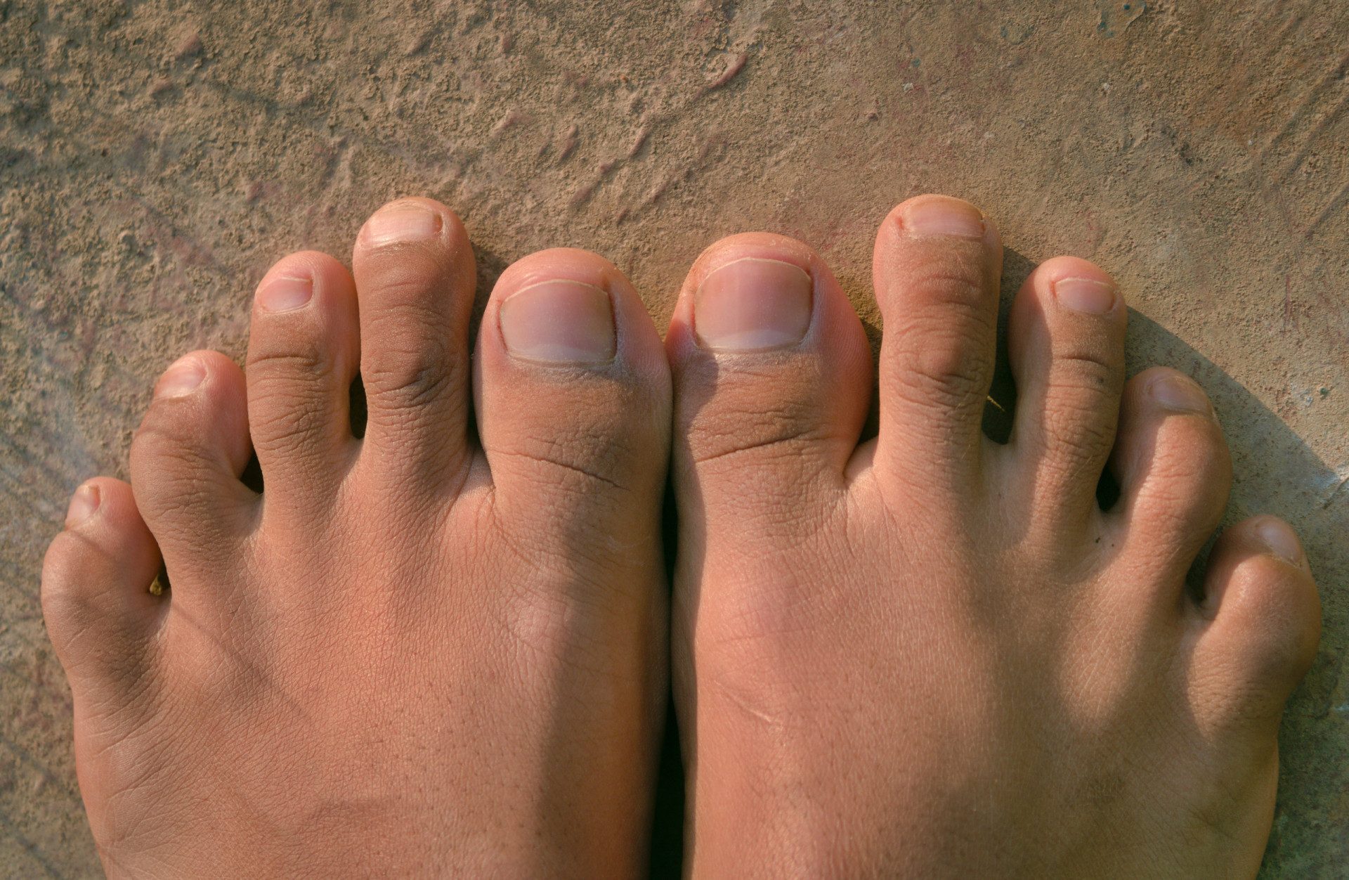 Understanding the link between toe shapes and personality traits