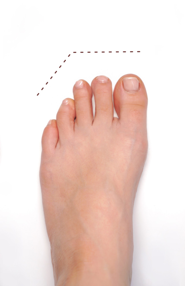 What does the shape of your toes reveal about you?