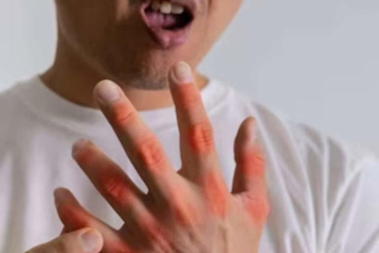 Why Dermatologists Recommend Patch Testing To Prevent Skincare Allergies