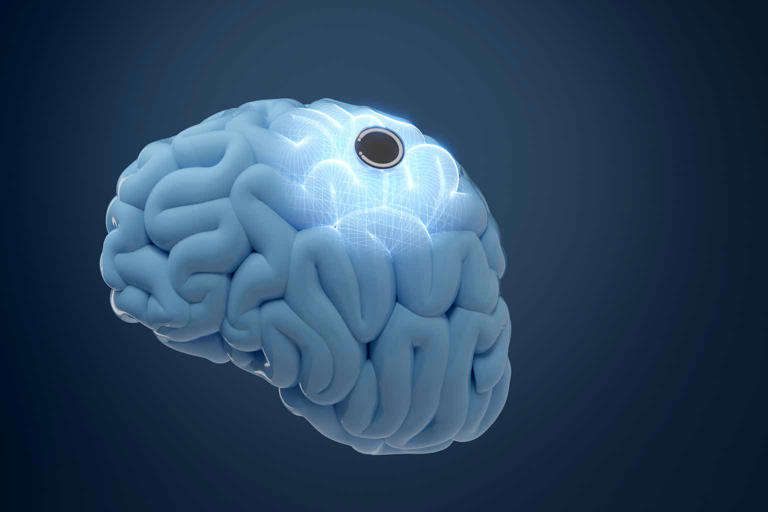 Neuralink to start high-volume production of brain implants this year