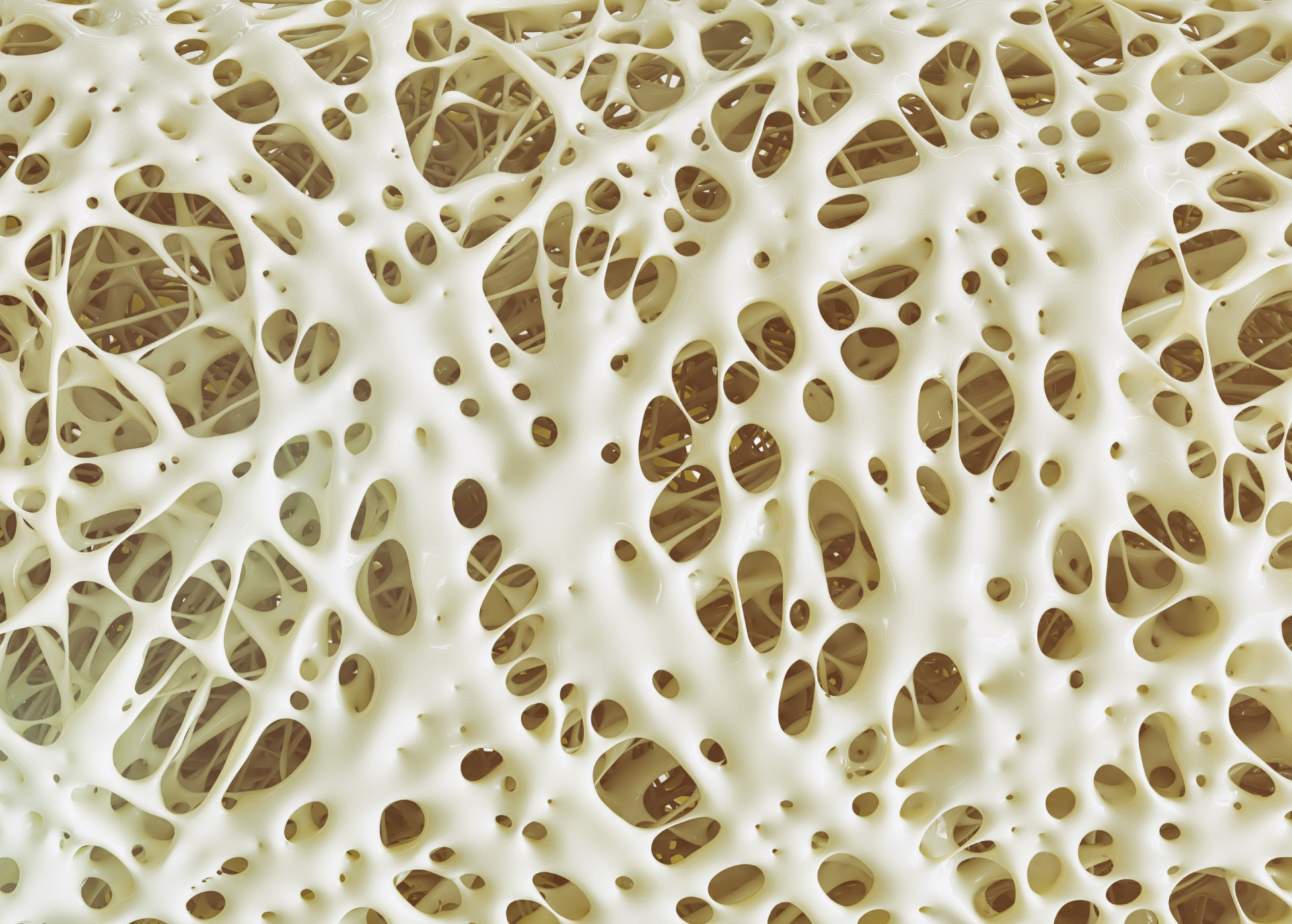 Osteoporosis: the "silent disease" is more common than you imagine