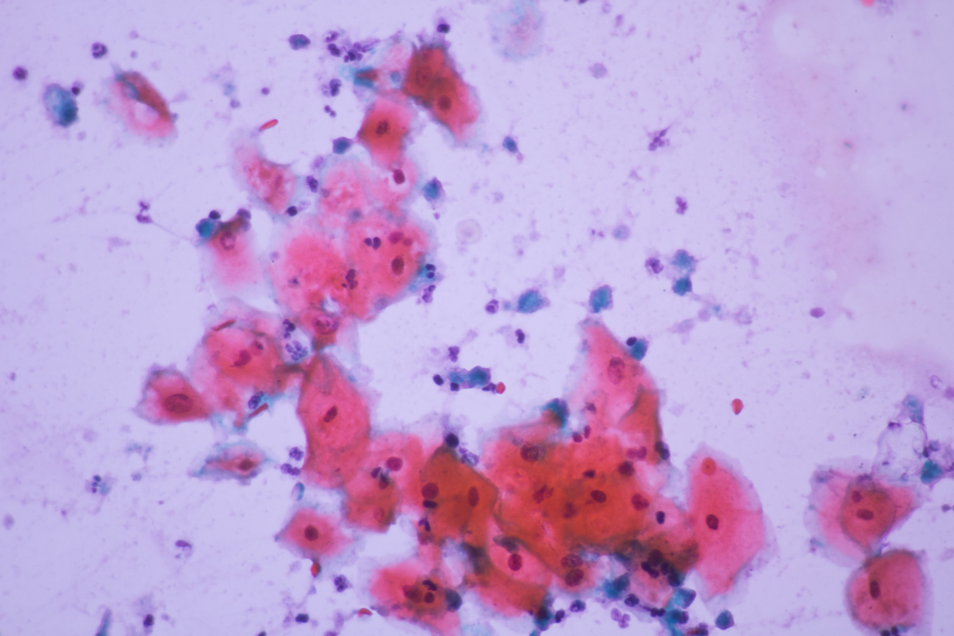 The 30 scariest parasitic diseases in the world