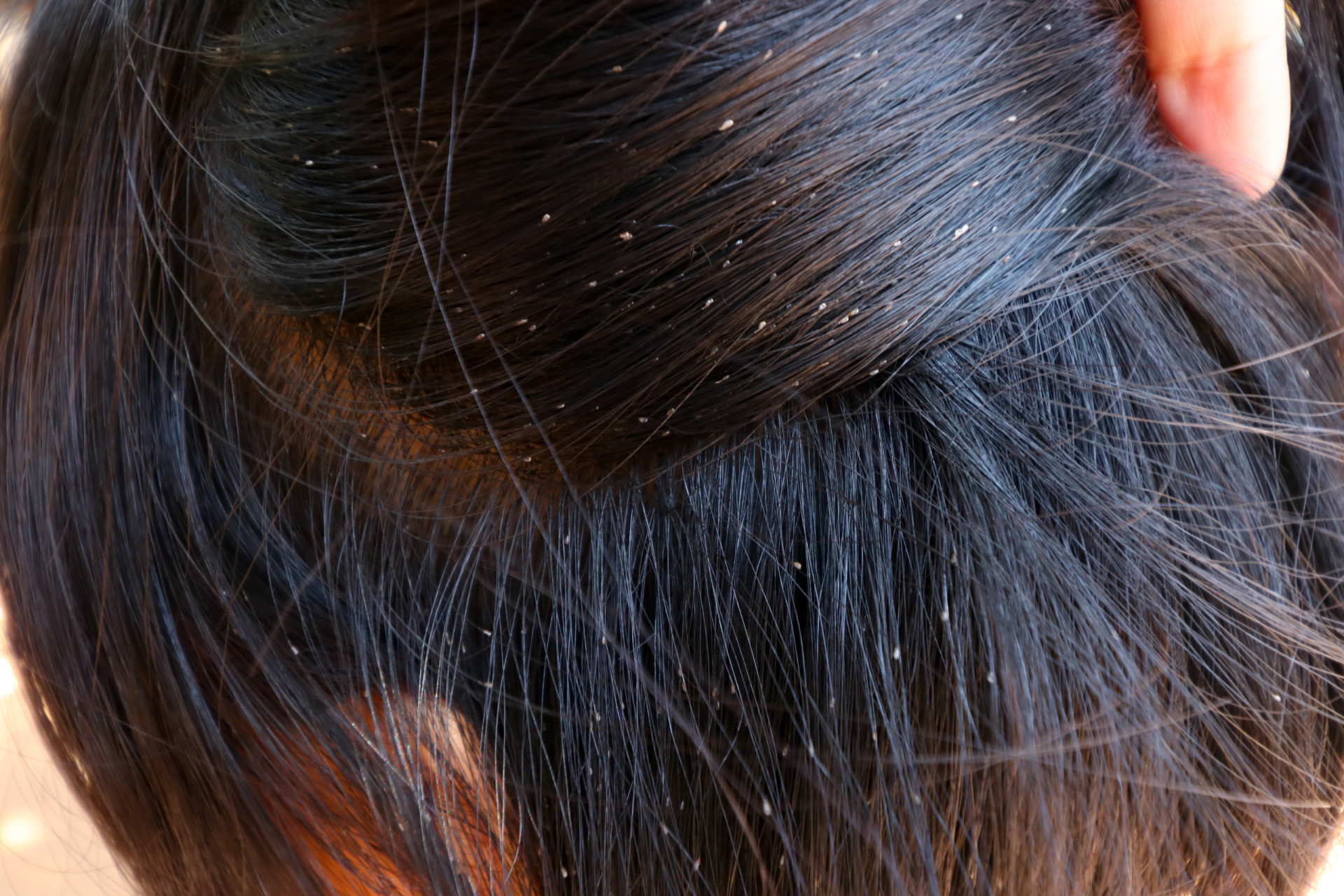 The 30 scariest parasitic diseases in the world