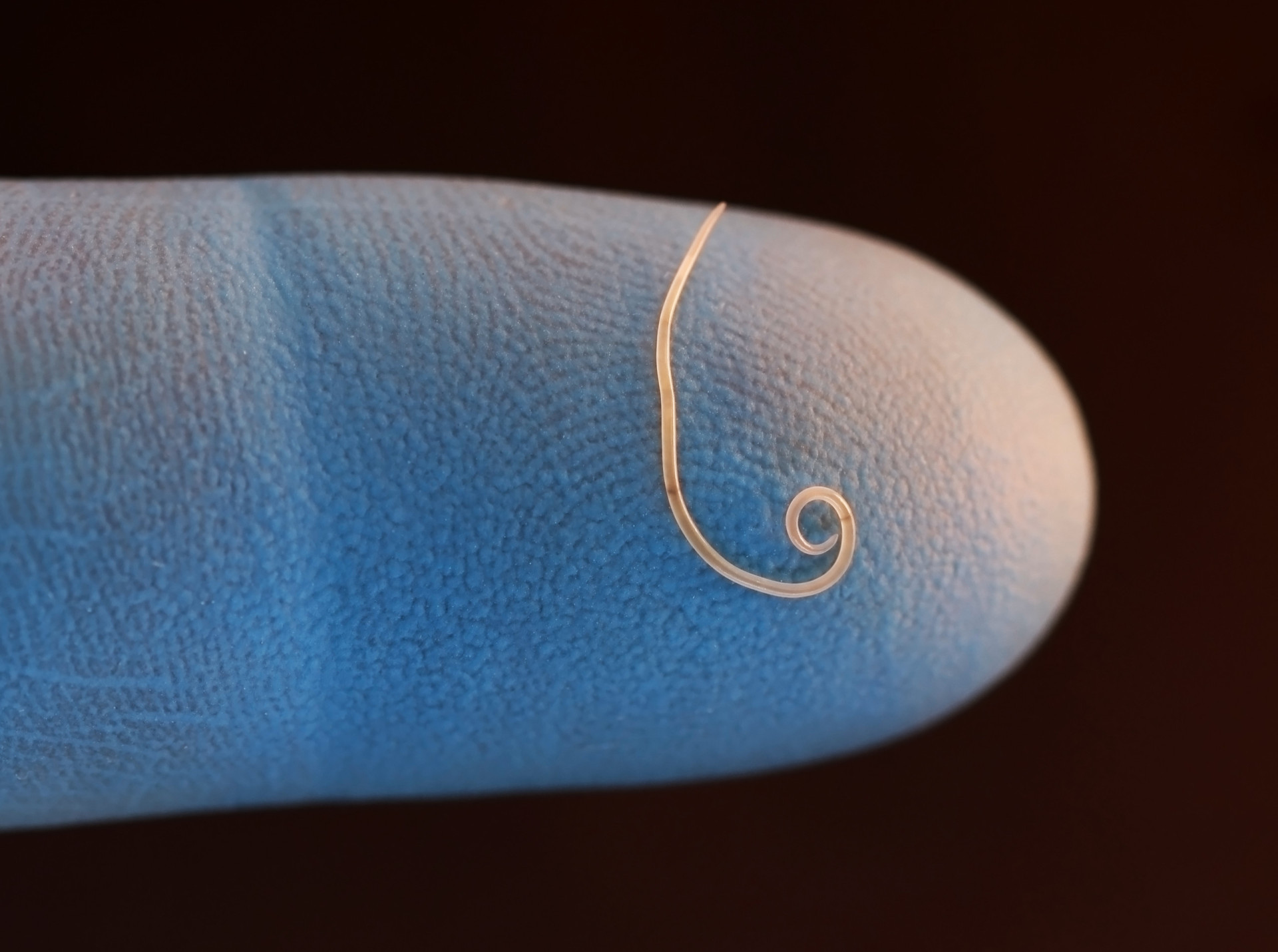 The 30 scariest parasitic diseases in the world