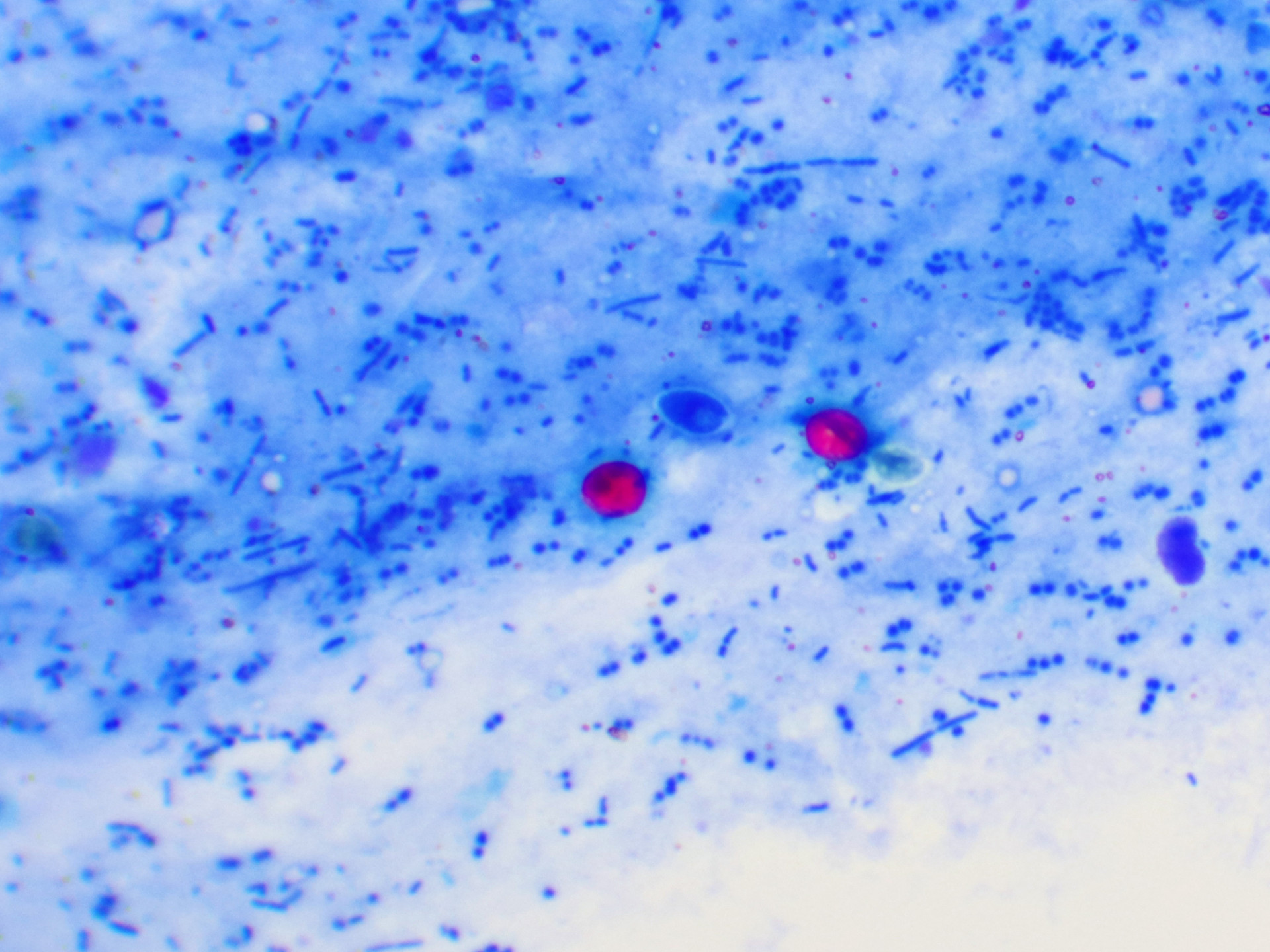 The 30 most terrifying parasitic diseases in the world