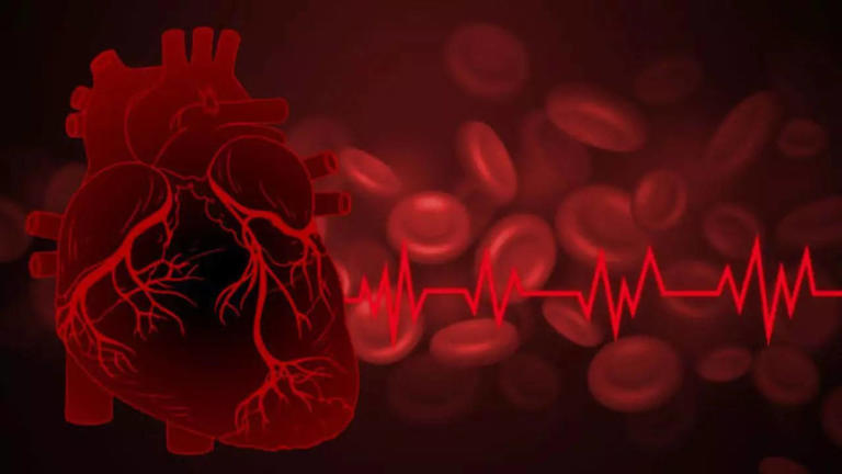 What Is Acute Coronary Thrombosis That Killed A US Banker After ...
