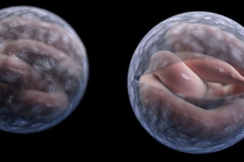 Suspected parasite outbreak leaves 28 people ill with 'nasty' sickness bug