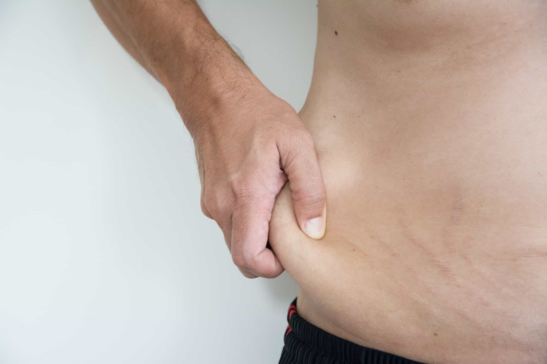 Den mørke side af ekstremt vægttab