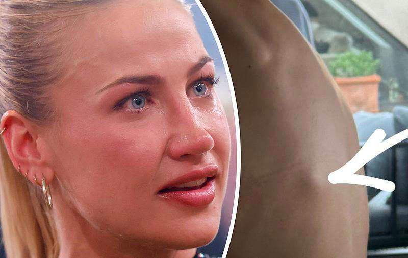 Lulu Lewe brach sich bei „Let’s Dance“ die Rippe - und das sieht man jetzt Lulu Lewe brach sich bei „Let’s Dance“ die Rippe - und das sieht man jetzt